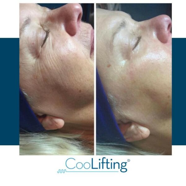 COOLIFT - Make-Over Studio